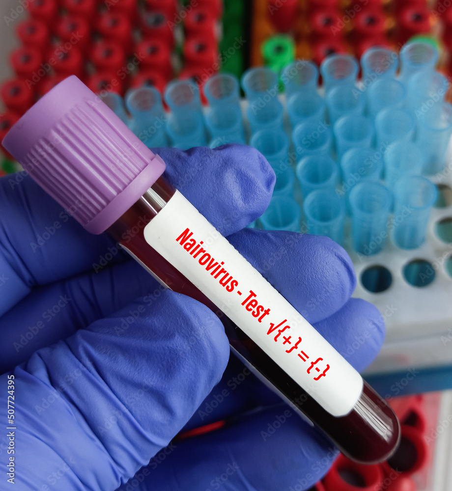 Blood sample for Nairovirus test, Congo hemorrhagic fever, Nairobi ...
