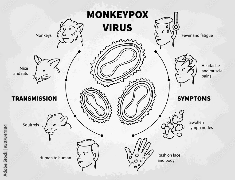 Monkeypox infectious disease vector infographic, medical scheme with ...
