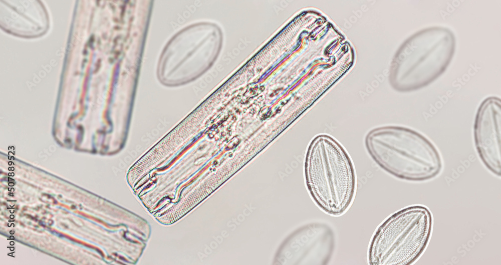Diatoms, algae under microscopic view, phytoplankton, fossils, silica ...