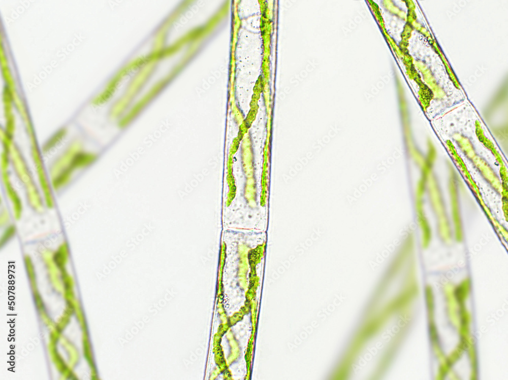 Spirogyra sp. green algae under microscopic view x40 - Chlorophyta ...