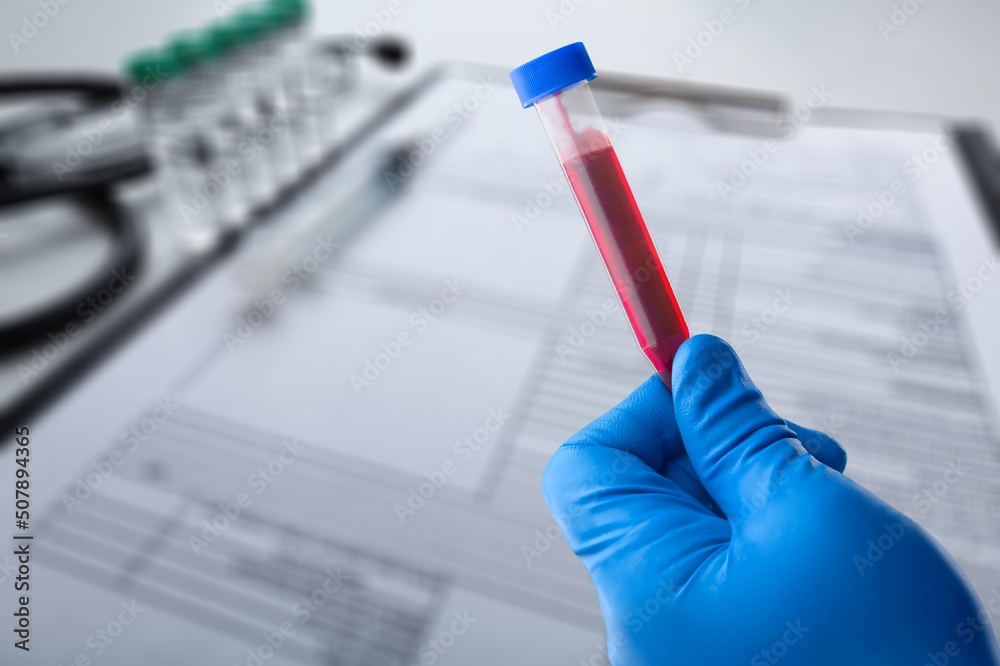 Blood sample tube for analysis of test in the laboratory. doctor ...