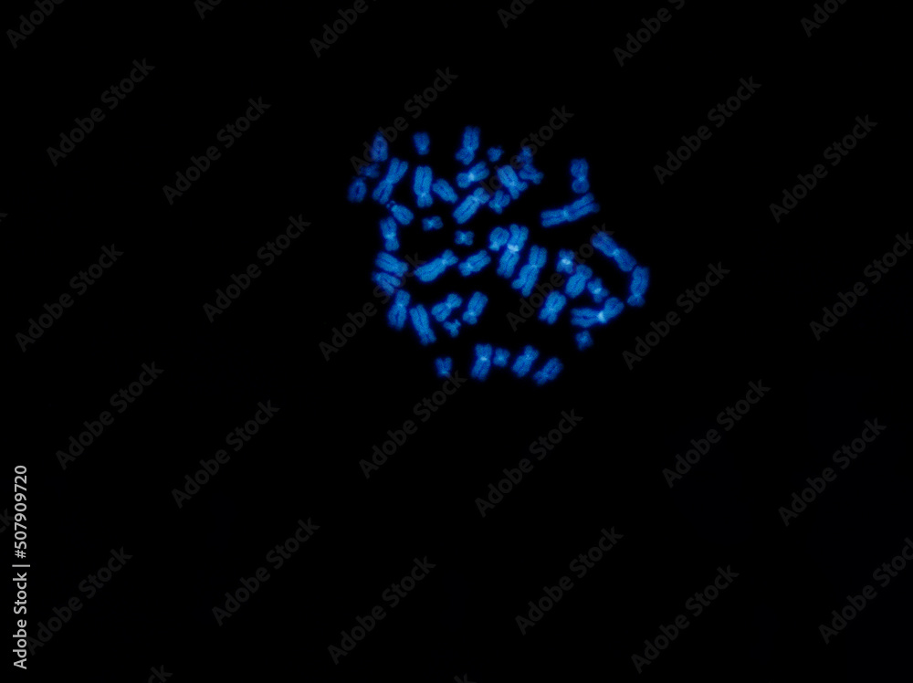 Chromosomes under fluorescence microscope, fluorescence in situ ...