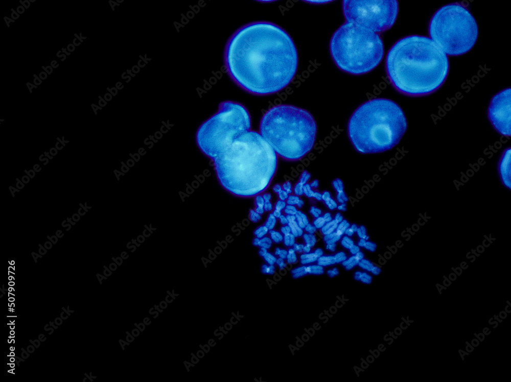 Poster Chromosomes under fluorescence microscope, fluorescence in situ ...