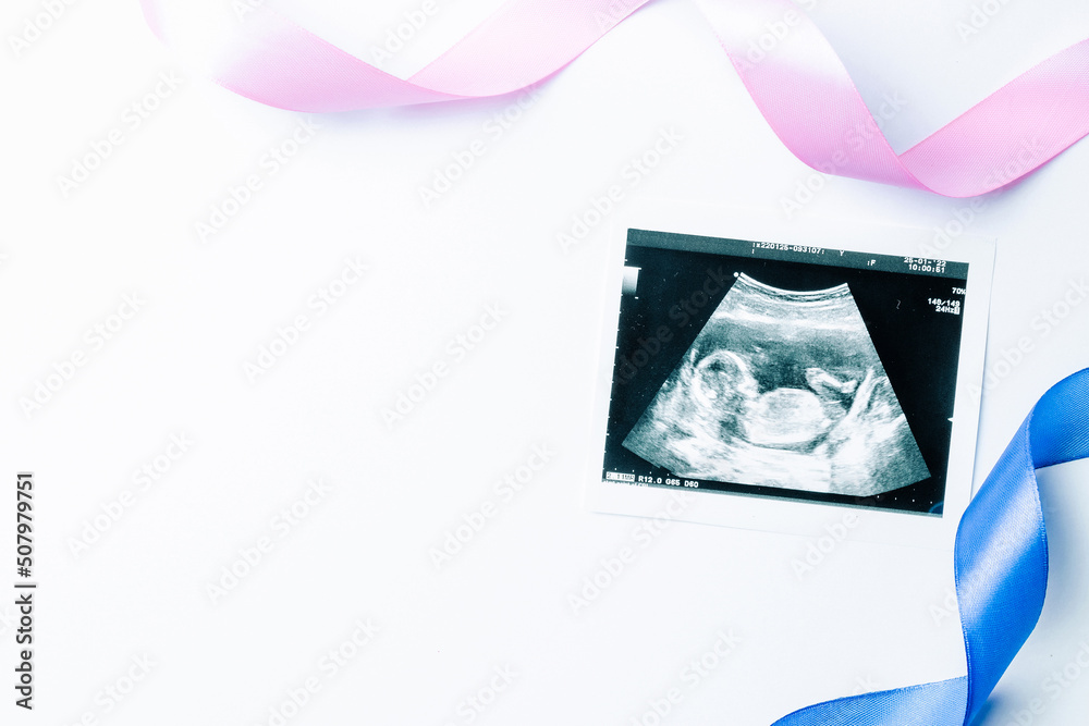 Ultrasound photo pregnancy baby. Blue, pink ribbon with ultrasound ...