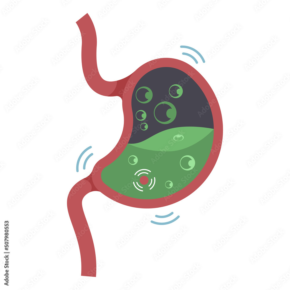 Gastric bloating vector cartoon illustration isolated on a white ...