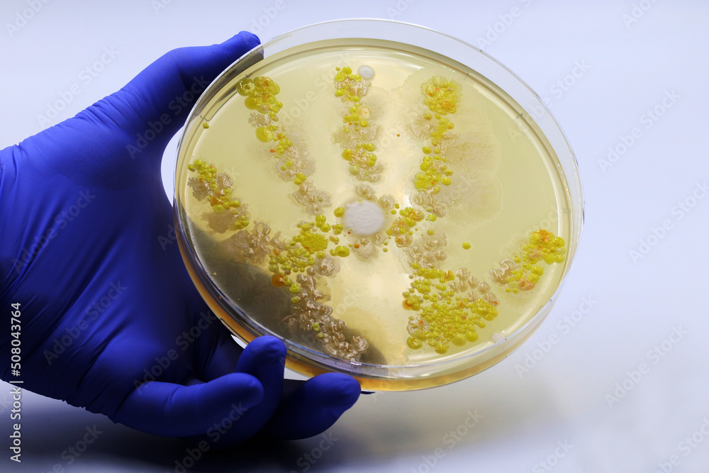 Germs on hands: colonies of bacteria and fungi in the hand of a young ...
