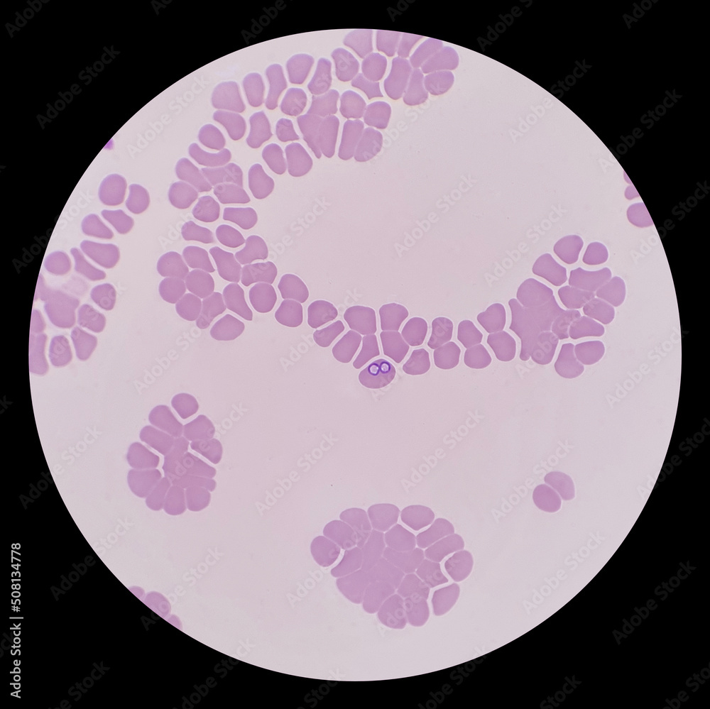 Foto de Babesia parasites inside red blood cell, the causative agent of ...