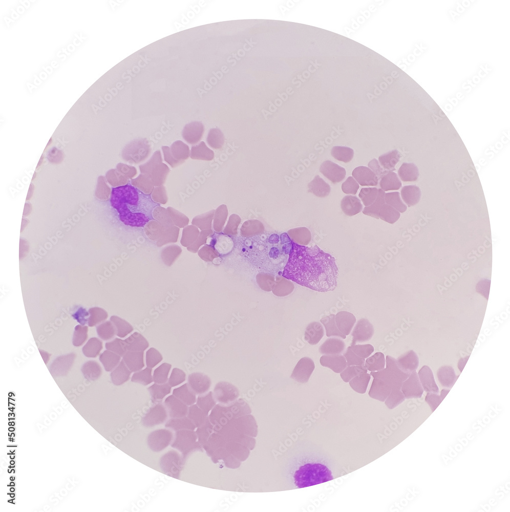 Phagocytosis of Babesia parasites by monocyte in canine blood, the ...