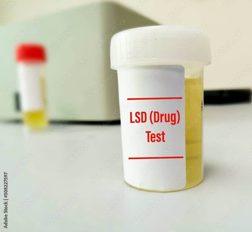 Urine sample for doping drug LSD test at medical laboratory for the ...