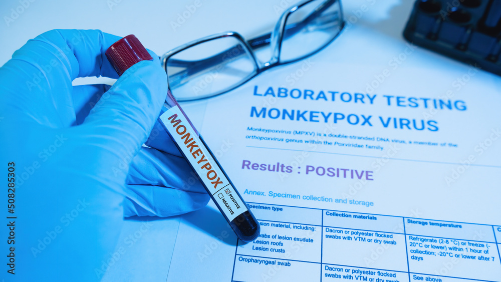 hand holding blood collection tubes and data sheet on monkeypox test ...