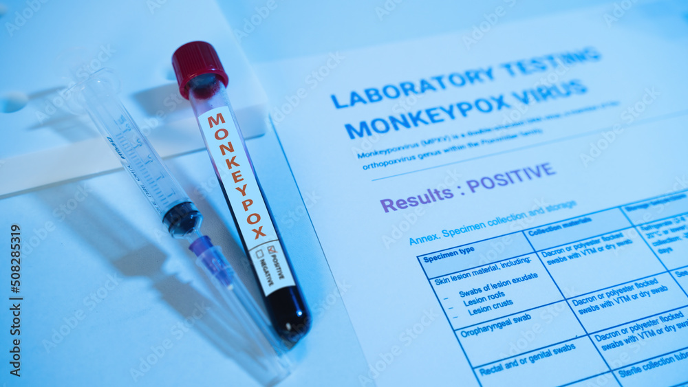 blood collection tubes and data sheet on monkeypox test positive ...