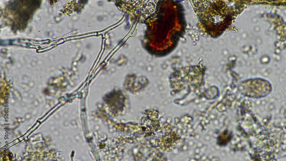Fungal and fungi hyphae under the microscope in the soil and compost ...