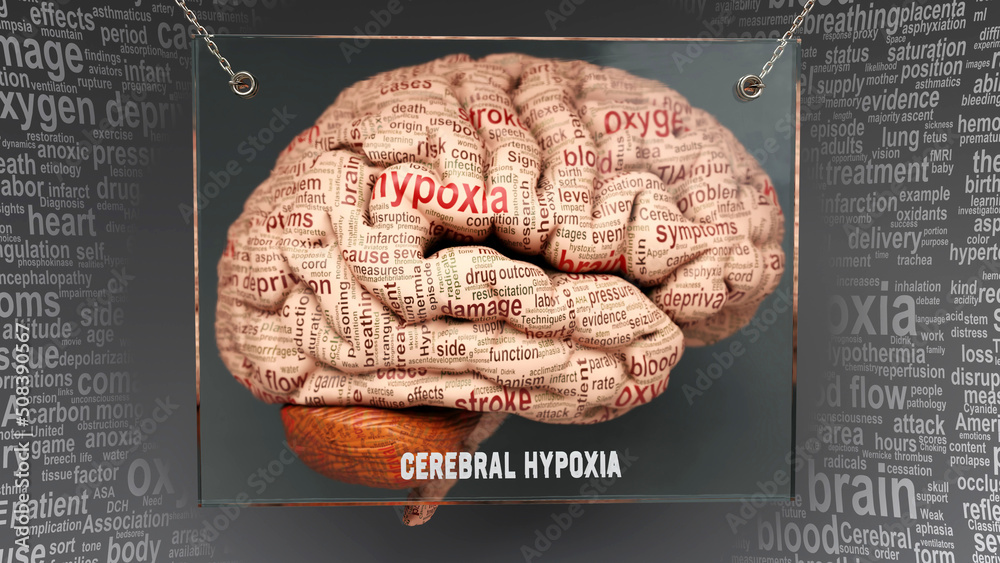 Cerebral hypoxia in human brain - dozens of terms describing its ...