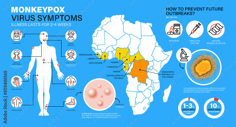 Monkeypox infographics. Monkeypox virus Symptoms. New cases of ...