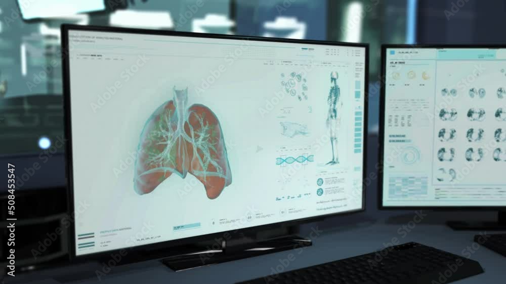Patients Coronavirus Diagnosis Checked By X-ray Scanning System ...