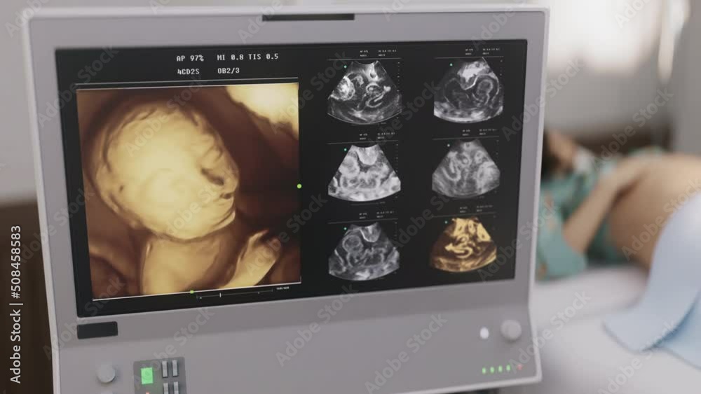 Medical Examination Device Used For Child Vital Signs Examination At ...