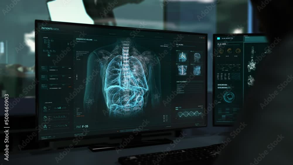 Medical Analysis System Diagnoses Cardiac Ischemia Disease By Scanning ...