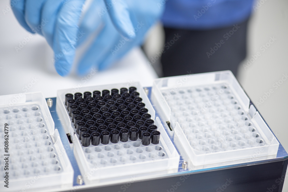 Medical scientists are examining HPV DNA in specimens from liquid-based ...