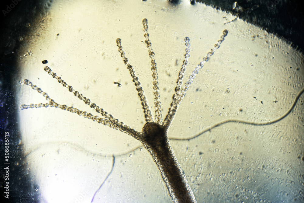 Hydra vulgaris under a light microscope, freshwater hydra taken from ...