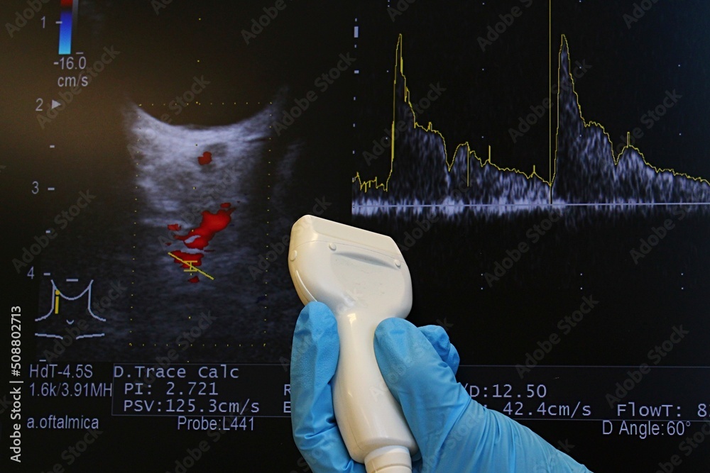 Modern linear ultrasound diagnostic probe held in doctor hand in blue ...