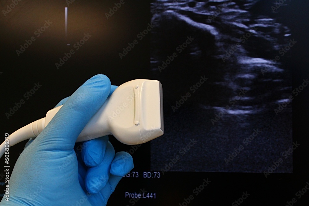 Modern linear ultrasound diagnostic probe held in doctor hand in blue ...