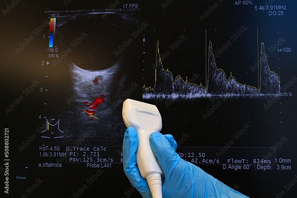 Modern linear ultrasound diagnostic probe held in doctor hand in blue ...