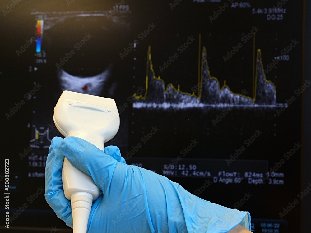 Foto de Linear ultrasound diagnostic probe held in doctor left hand in ...