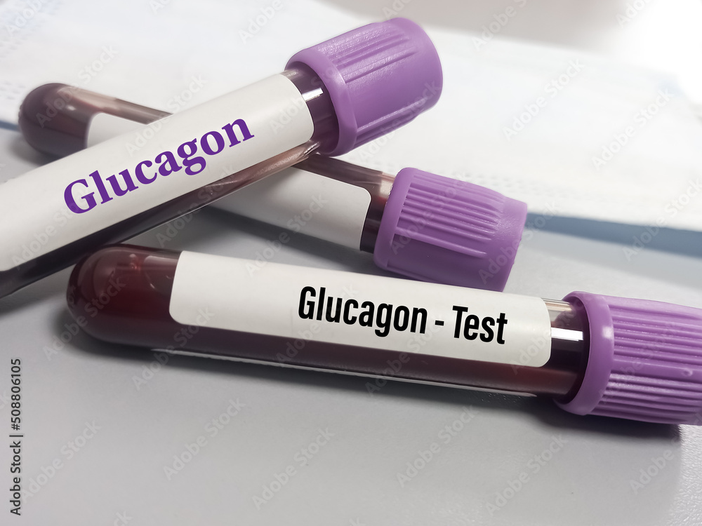 Blood sample for Glucagon test, another name: glucagon blood test ...