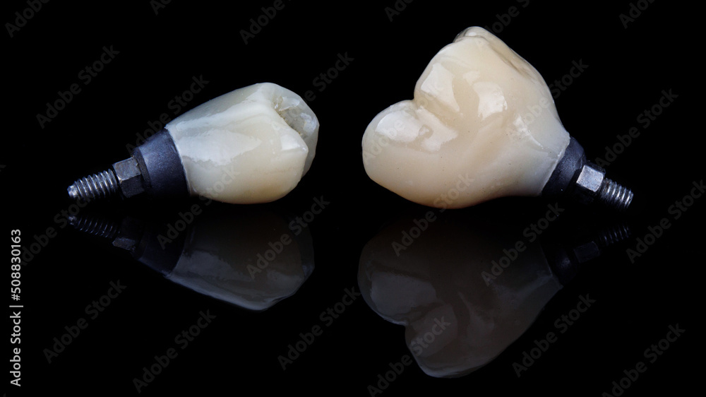 two dental crowns made of ceramic with prosthetics on black glass with ...