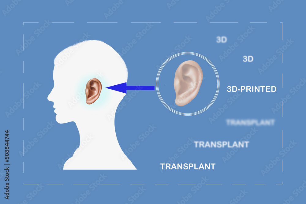 The concept of bioprinting of tissues and organs. The human ear is ...