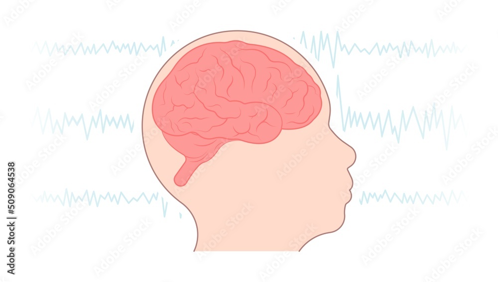 EMDR treat pelvic floor muscle TMS brain ADHD care test PTSD Post ...