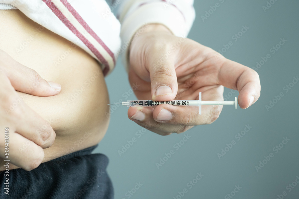 Diabetes melletus patient Subcutaneous Insulin injection at abdomen ...
