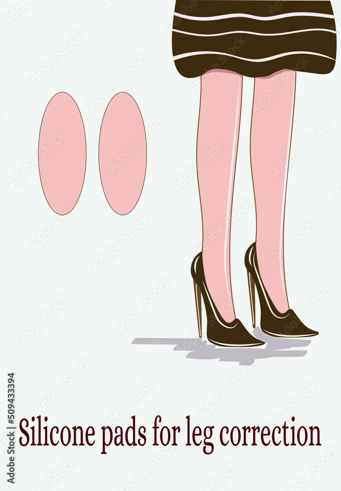 Silicone pads for the correction of female legs. Example template. Girl ...
