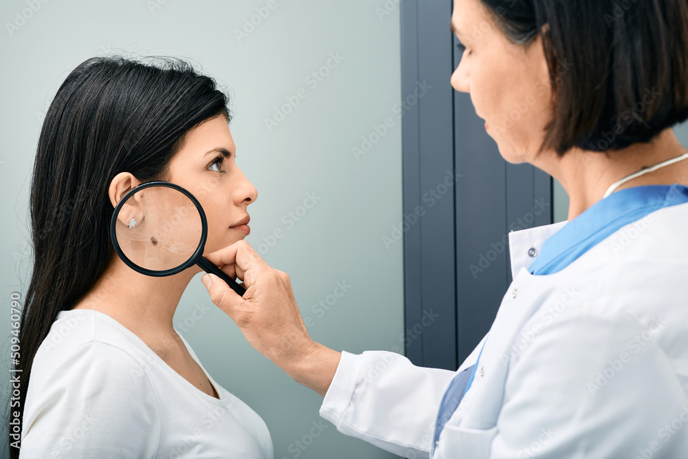 Mole dermoscopy, preventive of melanoma. Doctor examining woman's neck ...