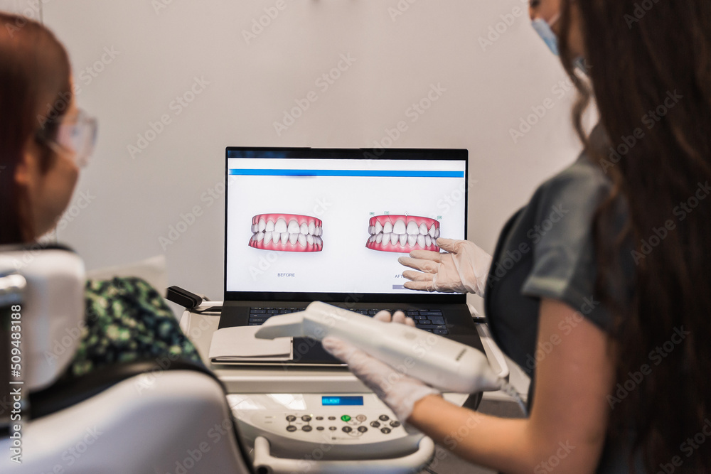 The famale dentist shows digital model of female patient's teeth made ...