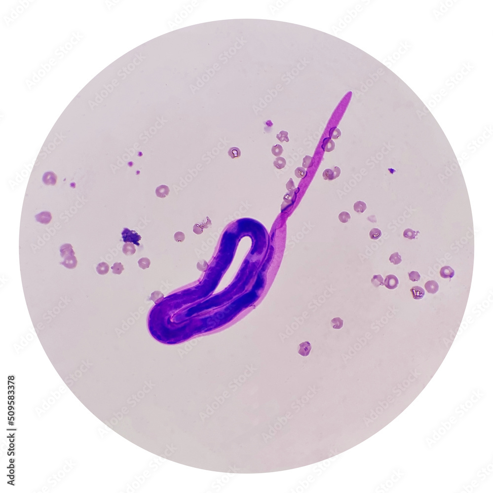 Microfilaria are sheathed in the blood smear of cattle. Light ...