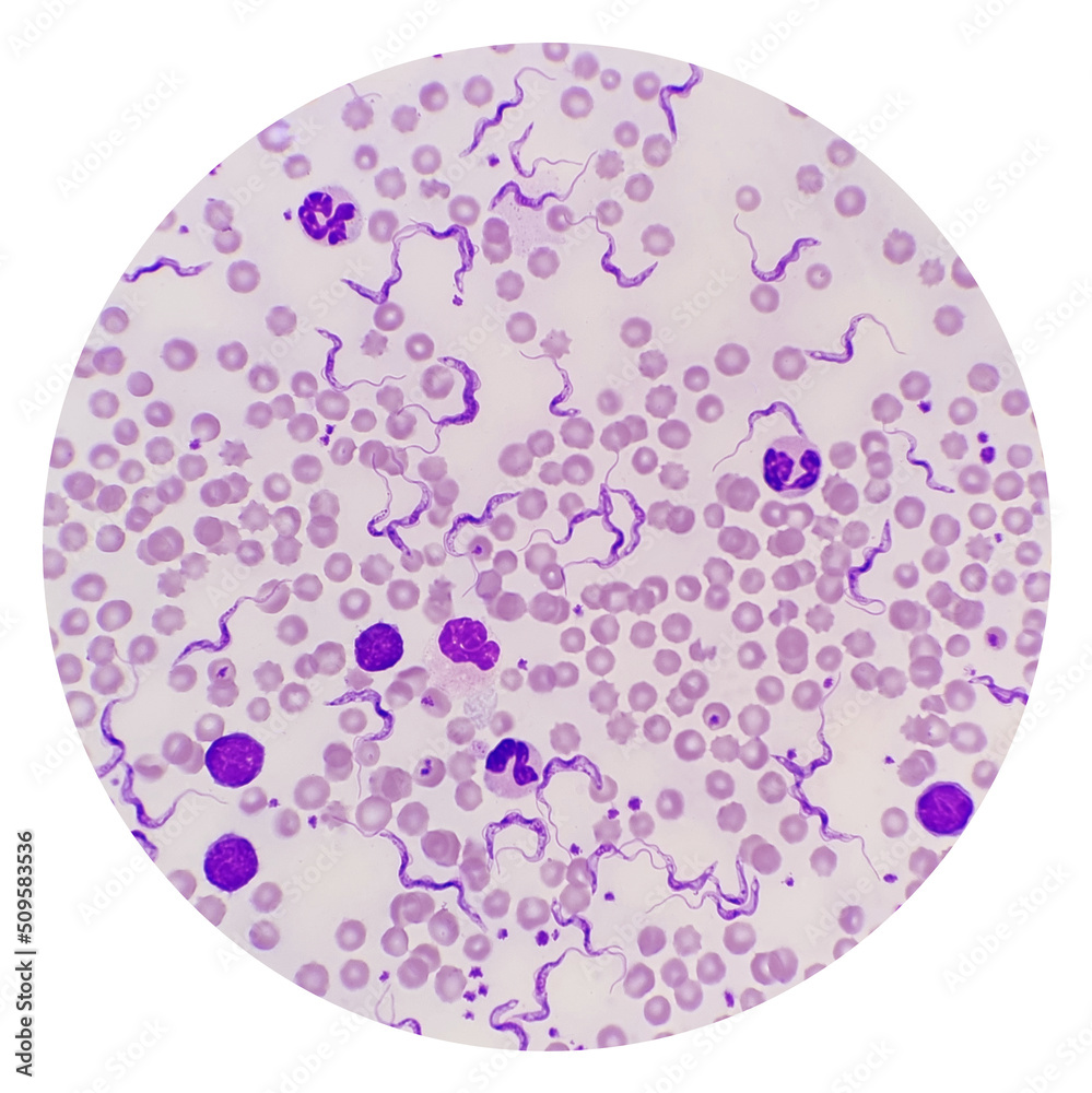 Trypanosoma sp. among red blood cells. Trypanosome species in blood ...