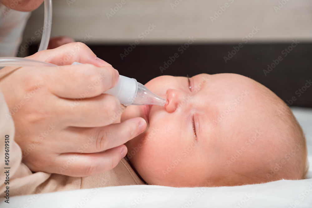 Mother cleans nose of little girl from snot using aspirator on blurred ...