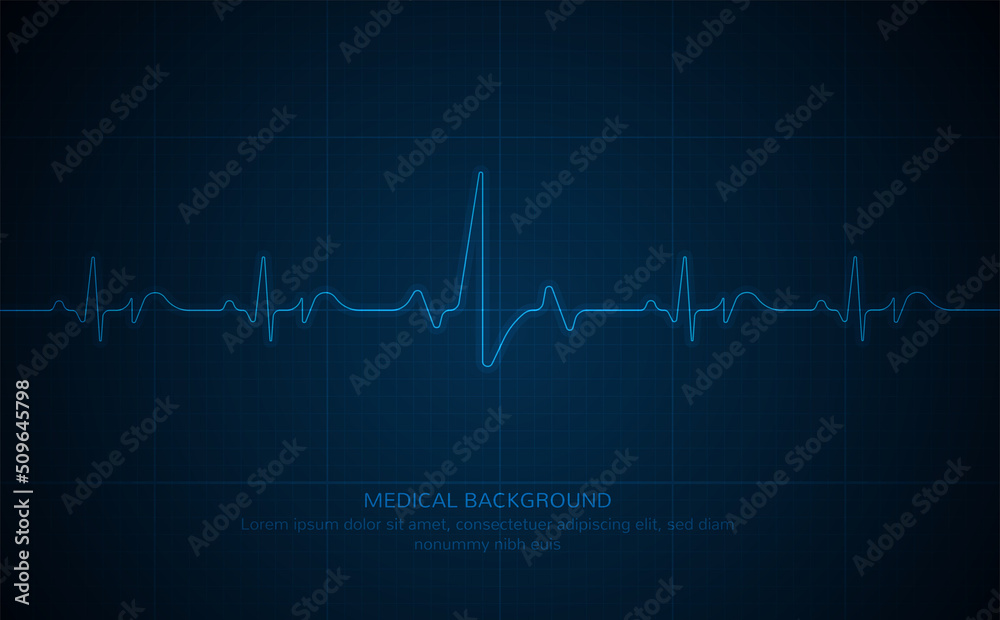Emergency ekg monitoring. Blue glowing neon heart pulse. Heart beat ...