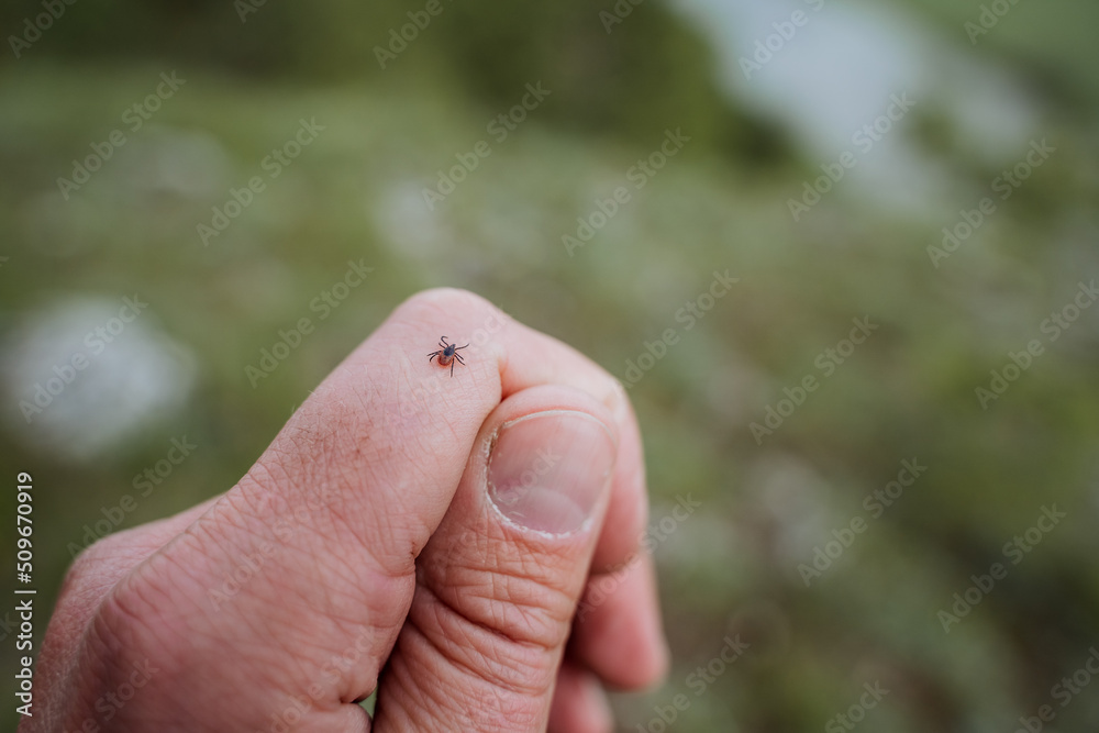 Poster Encephalitis tick crawls on the skin, a harmful insect spreads ...