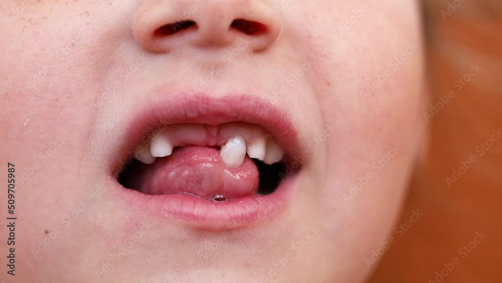 Unrecognizable close up kid mouth, baby milk teeth problem. Touching by ...