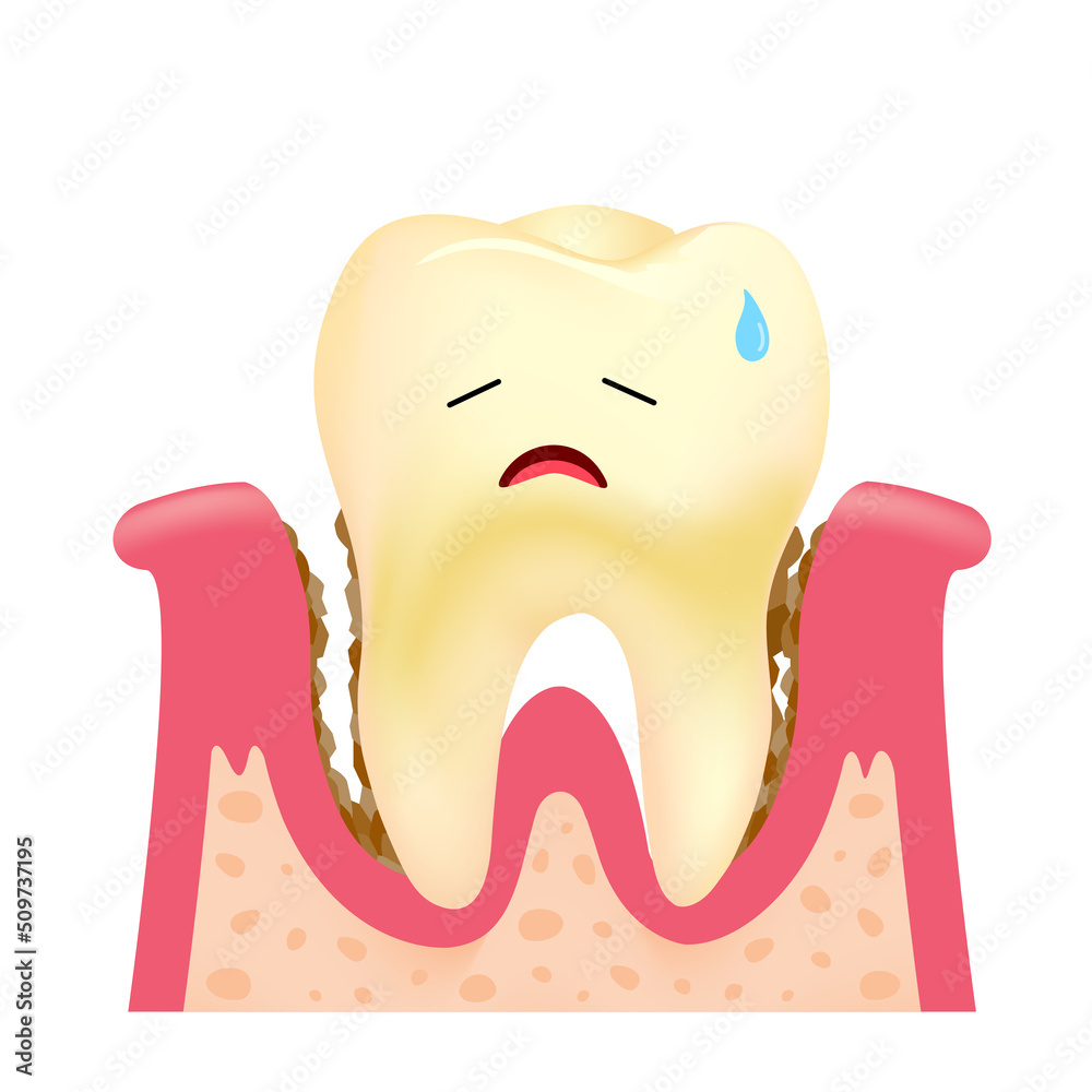 Cute cartoon tooth character with gums. Dental plaque problem ...