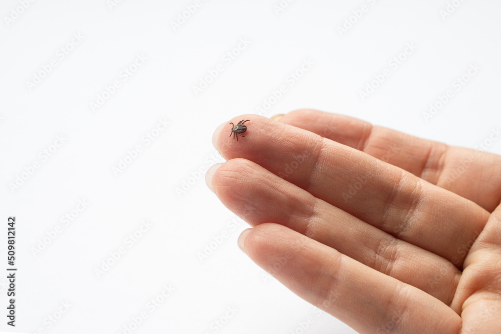 Infected female deer tick on human hand skin. isolated on white ...