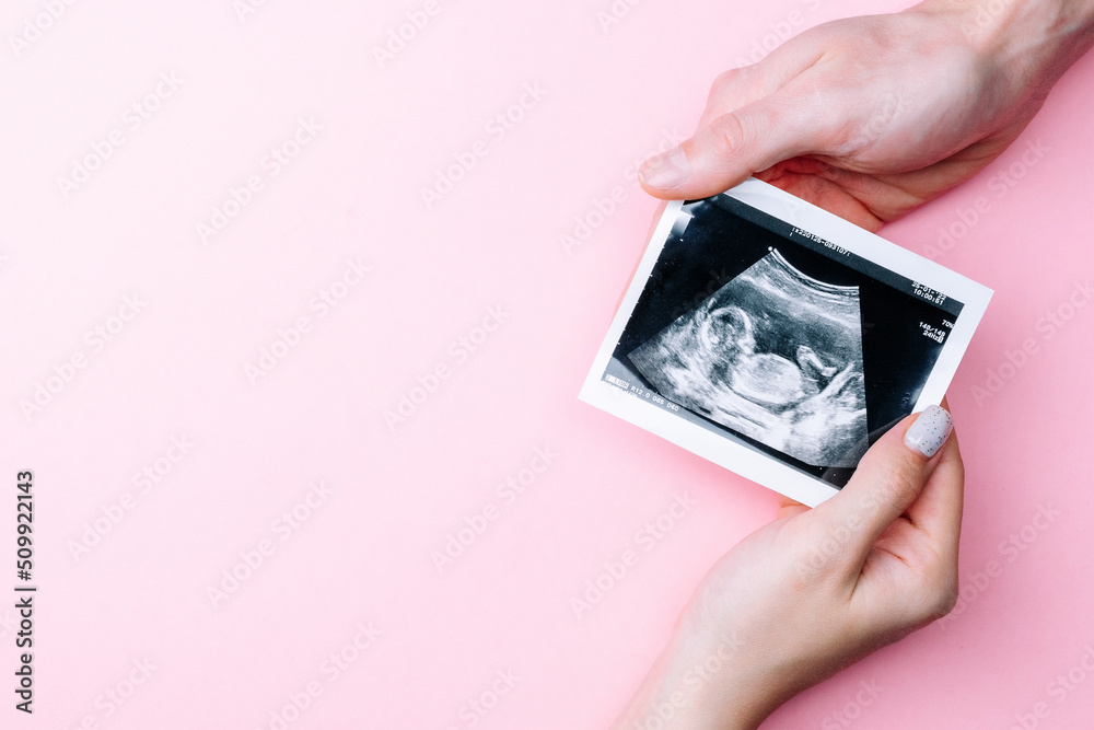 Ultrasound photo pregnancy baby. Woman hands holding ultrasound ...