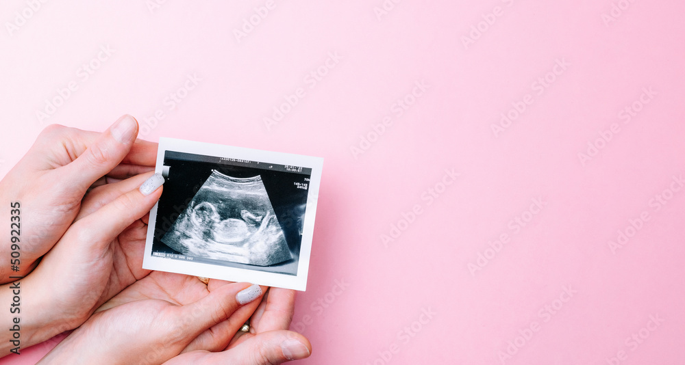 Ultrasound photo pregnancy baby. Woman hands holding ultrasound ...