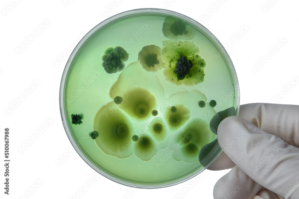Hand with Petri dish or culture media with bacteria on white background ...