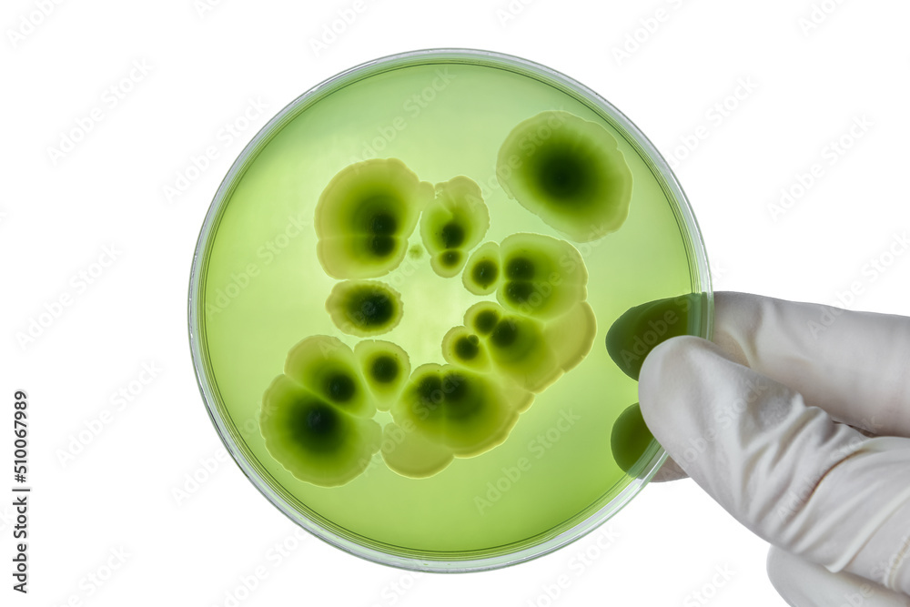 Hand with Petri dish or culture media with bacteria on white background ...