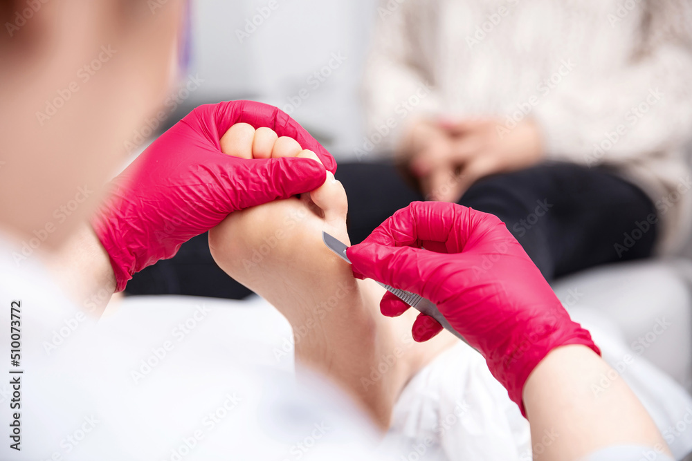 Poster Medical pedicure procedure using special instrument with blade ...