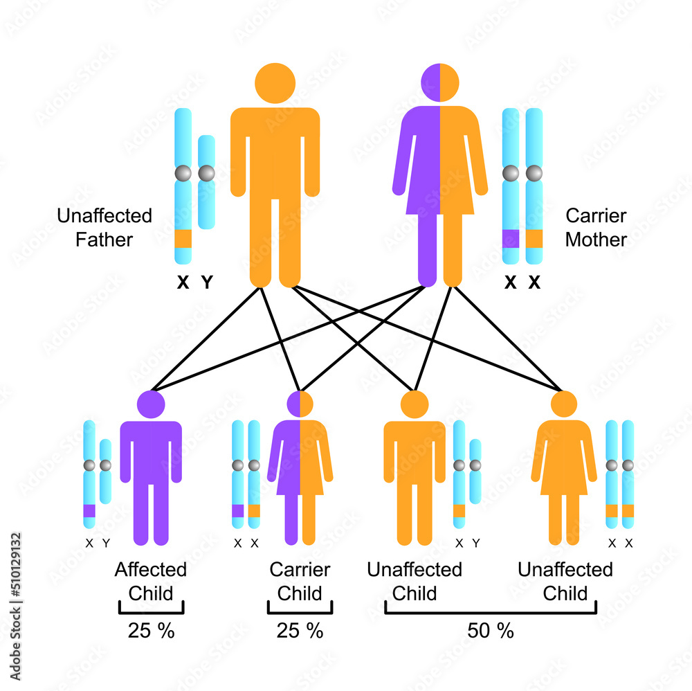 Scientific Designing of X-Linked Recessive Inheritance. Colorful ...
