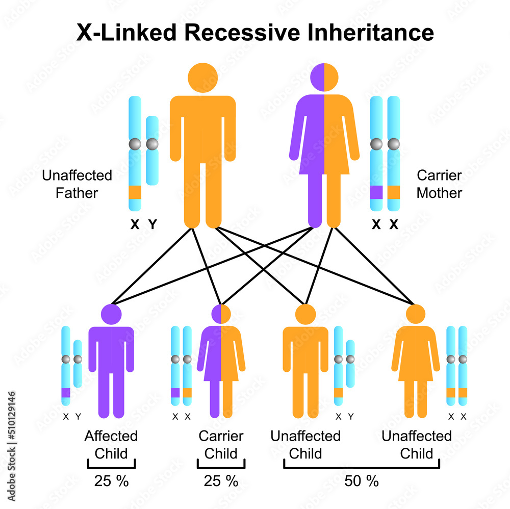 Scientific Designing of X-Linked Recessive Inheritance. Colorful ...